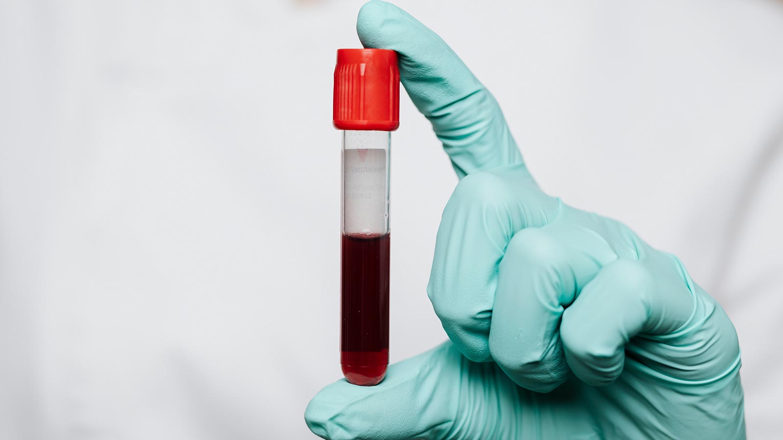 Convenient Walk-In Blood Tests - Urgent Care in Chicago